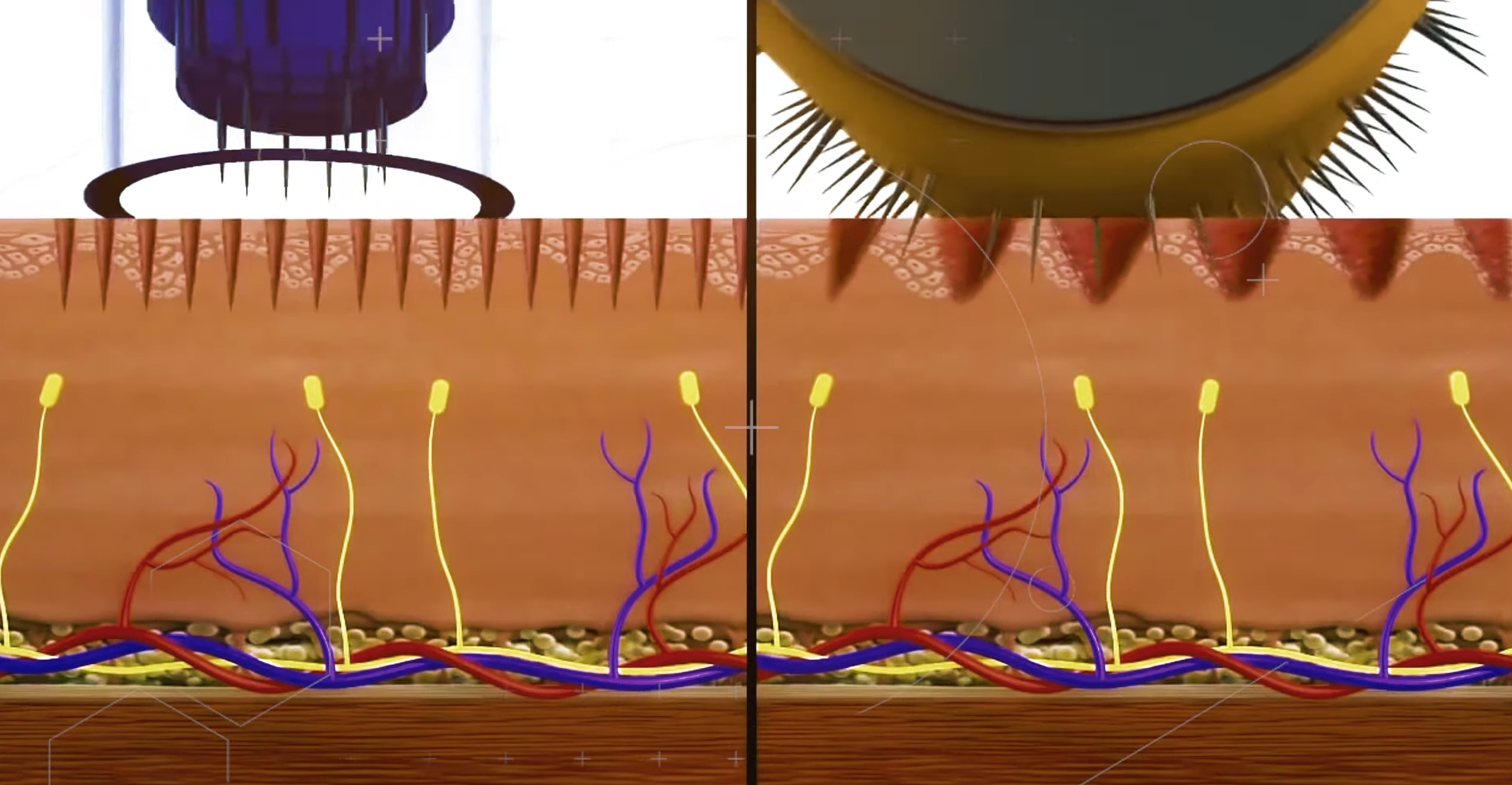 What Is Microneedling and How Can It Benefit Your Skin?